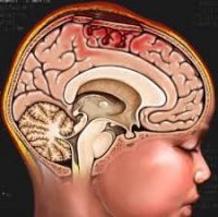 Pediatric Head Injury | Emergency Medicine Cases