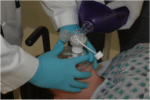 Emergency Airway Controversies | Emergency Medicine Cases