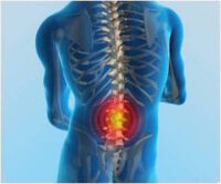 Low Back Pain Emergencies | Emergency Medicine Cases