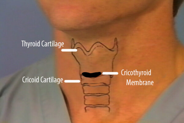 Central Lines, Cricothyrotomy & Pericardiocentesis | EM Cases