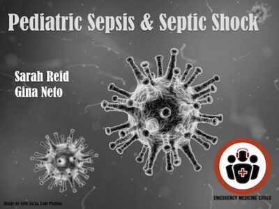Recognition & Management of Pediatric Sepsis & Septic Shock