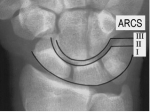Commonly Missed Uncommon Orthopedic Injuries