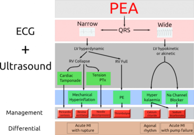 PEA Arrest, PseudoPEA & PREM | Emergency Medicine Cases