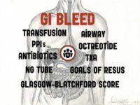 GI Bleed Emergencies | EM Cases | Main Episode