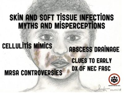 Skin and Soft Tissue Infections | Emergency Medicine Cases | EM Cases