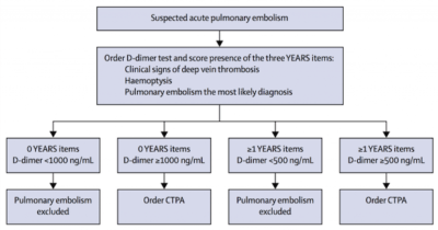 Pulmonary Embolism Challenges in Diagnosis Part 1 | Emergency Medicine ...