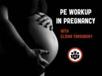 Pulmonary Embolism Workup in Pregnancy | EM Cases | Best Case Ever