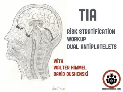TIA Update - Risk Stratification, Workup, Dual Antiplatelet Therapy ...