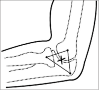 Ep 121 Elbow Injuries - Ten Pitfalls in Diagnosis and Management ...