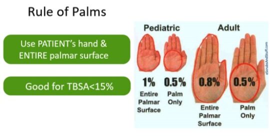 Burn and Inhalation Injury: ED Wound Care, Resuscitation & Airway | EM ...