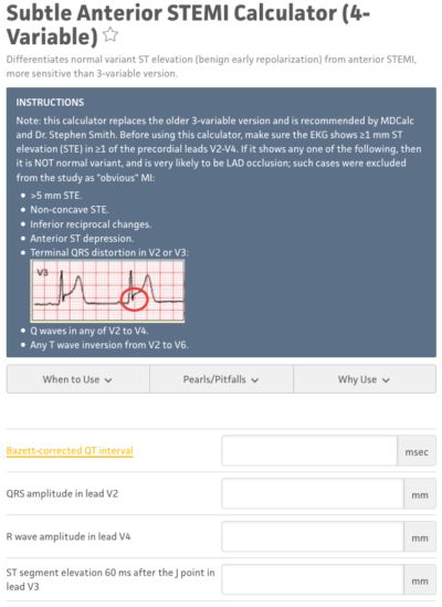 early repolarization or anterior STEMI | ECG cases | EM cases