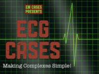 ECG Cases blog | Emergency Medicine Cases