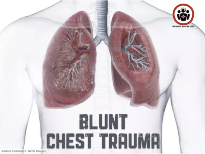 Shock and Hypoxia in Blunt Chest Trauma | CritCases 13 | EM Cases