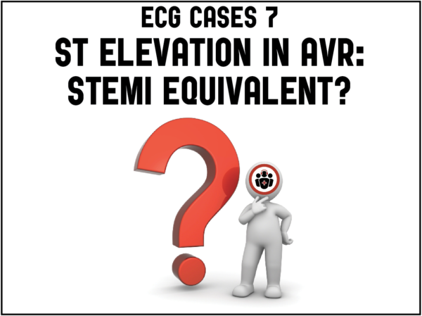 ST elevation in aVR, STEMI equivalent? | ECG Cases| Emergency Medicine ...