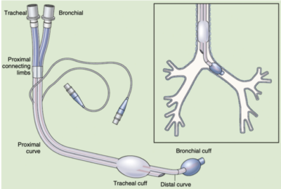 Bronchopleural Fistula Management | CritCases | EM Cases
