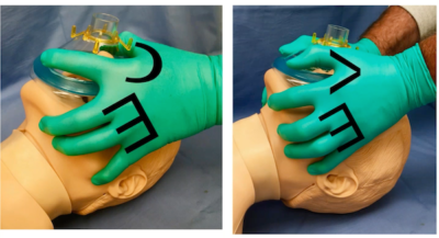 Protected Intubation | Emergency Medicine Cases