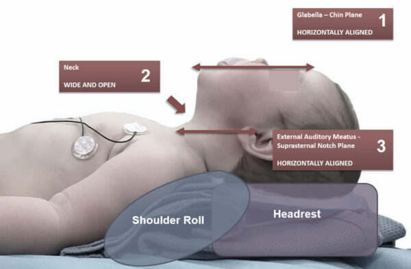 EM Cases: Neonatal Resuscitation - emDocs