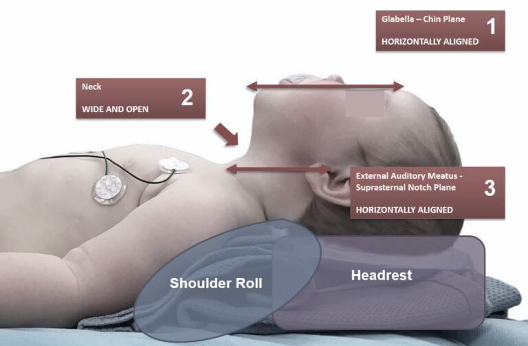 EM Cases: Neonatal Resuscitation - emDocs