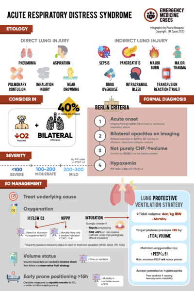 EM Quick Hits 23 | Adjusted D-dimer, ARDS, Pharyngitis Mimics ...