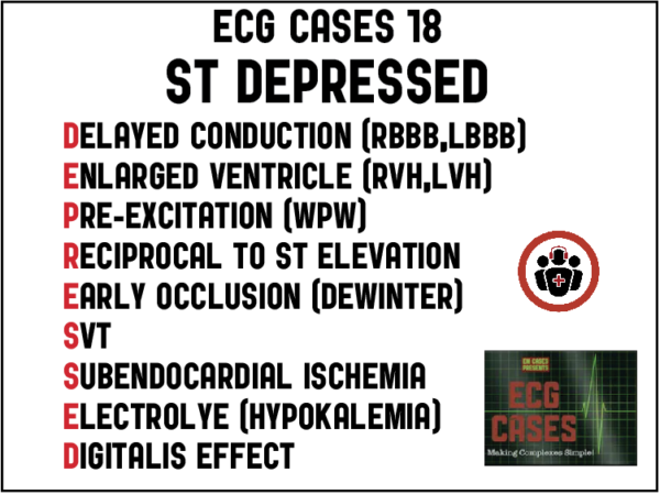 ST DEPRESSED mnemonic and Occlusion MI | ECG Cases | EM Cases