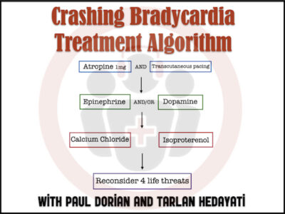 Treatment of Bradycardia and Bradydysrhythmias | Emergency Medicine Cases