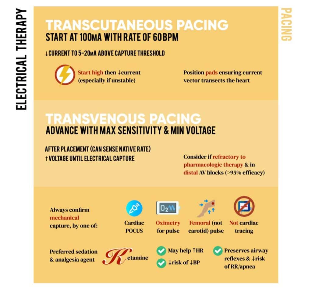 Treatment of Bradycardia and Bradydysrhythmias | Emergency Medicine Cases
