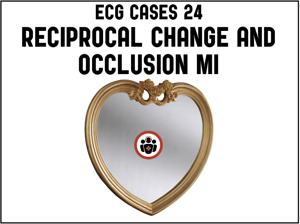 Stemi Archives Emergency Medicine Cases 4516