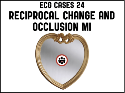 Reciprocal Changes and Occlusion MI | ECG Cases | Emergency Medicine Cases
