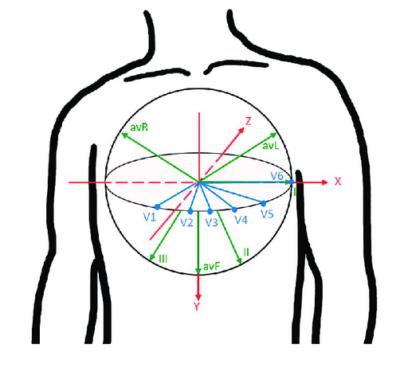 Reciprocal Changes and Occlusion MI | ECG Cases | Emergency Medicine Cases