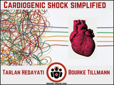 Cardiogenic Shock Simplified | Emergency Medicine Cases