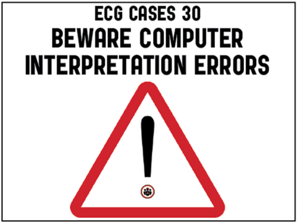 Beware Computer Interpretation Errors | ECG Cases | EM Cases