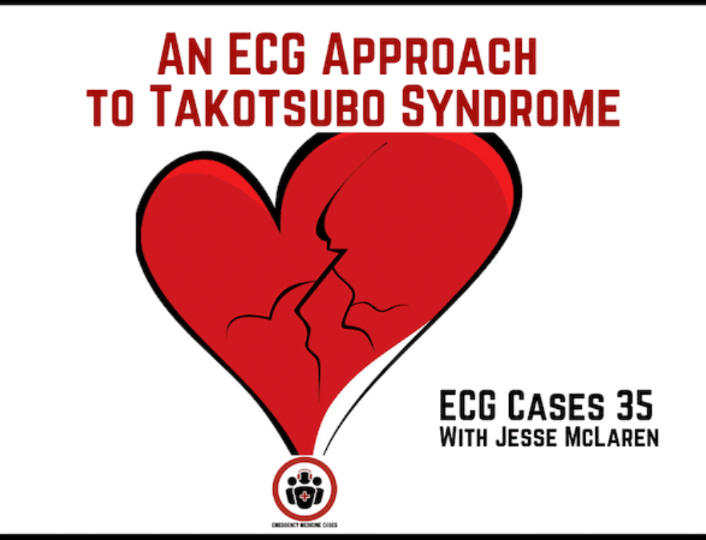 Low and Slow Poisoning | Emergency Medicine Cases | EM Cases