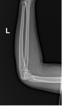 Emergency Orthopedics Differential Diagnosis - SCARED OF mnemonic | EM ...