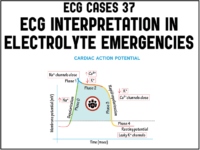 ECG interpretation in electrolyte emergencies | ECG Cases | EM Cases