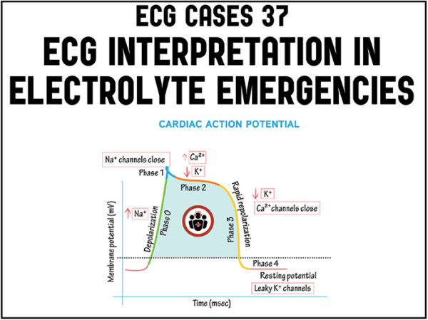 ECG interpretation in electrolyte emergencies | ECG Cases | EM Cases