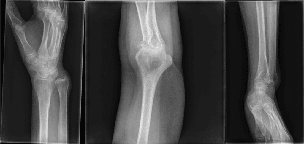 Orthopedic X-rays Masterclass | Emergency Medicine Cases