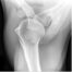 Orthopedic X-rays Masterclass | Emergency Medicine Cases