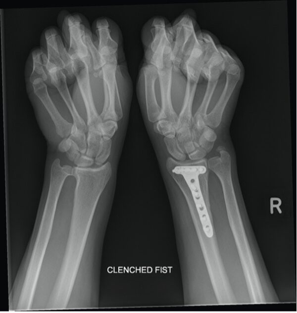Orthopedic X-rays Masterclass | Emergency Medicine Cases