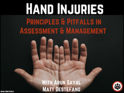 Hand Injuries - Pitfalls in Assessment | Emergency Medicine Cases
