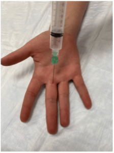 Hand Injuries - Pitfalls in Assessment | Emergency Medicine Cases