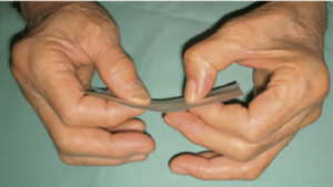 Hand Injuries - Pitfalls in Assessment | Emergency Medicine Cases