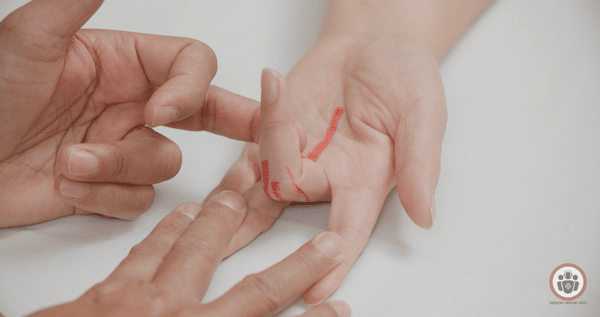 Hand Exam Masterclass | EM Cases Summit Video
