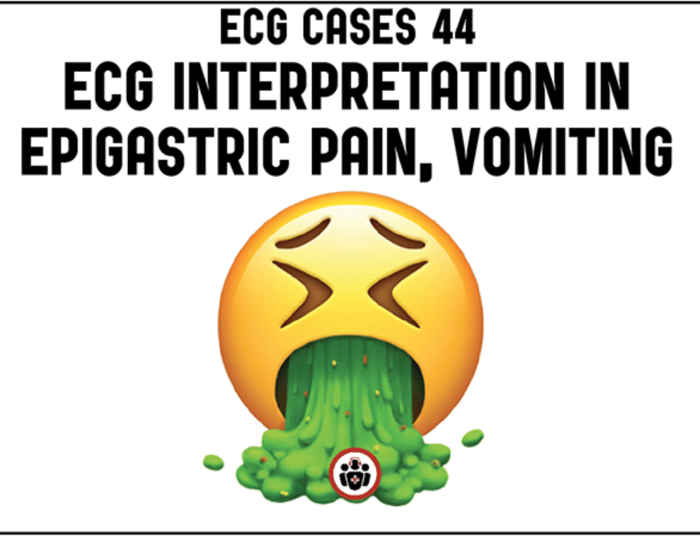 Low and Slow Poisoning | Emergency Medicine Cases | EM Cases