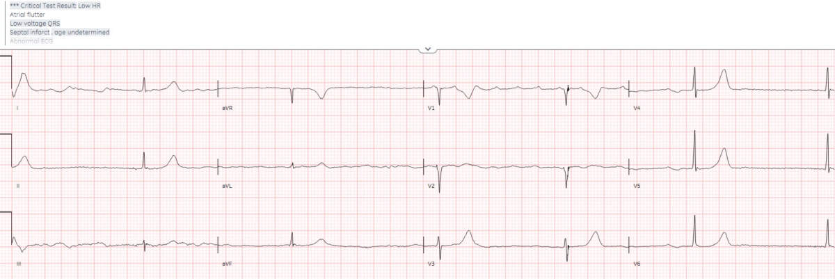 ECG Interpretation in Toxicology | ECG Cases | EM Cases