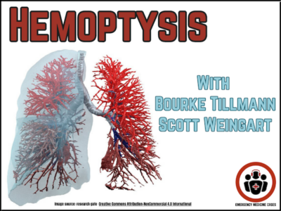 Hemoptysis ED Approach and Management | EM Cases