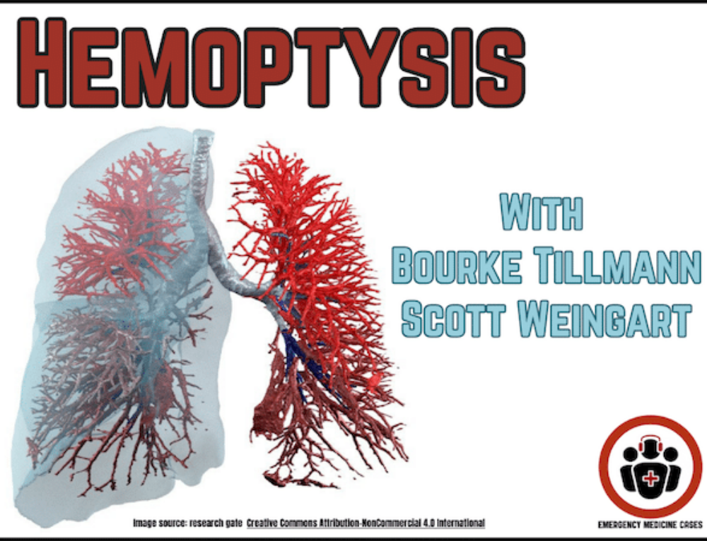 DOACs Use and Misuse, DVT & atrial fibrillation | EM Cases
