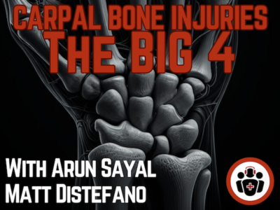 Carpal Bone Injuries - The Big 4 | Emergency Medicine Cases