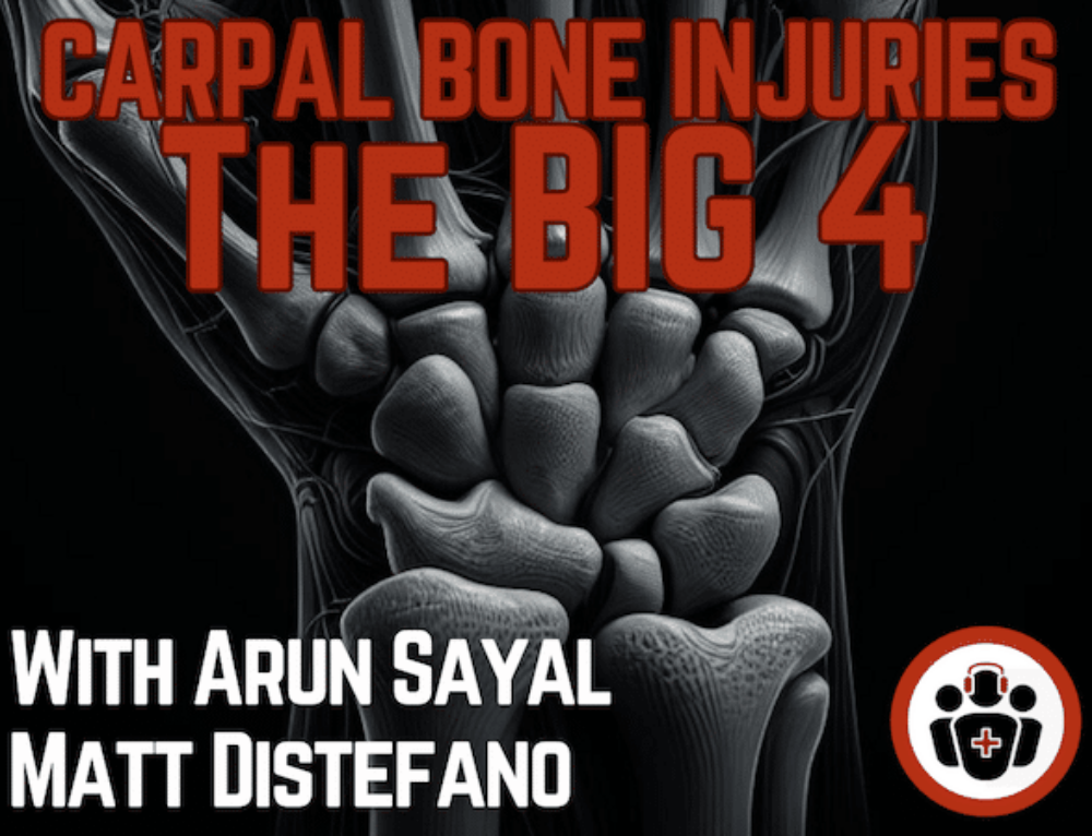 Electrical Injuries | Emergency Medicine Cases