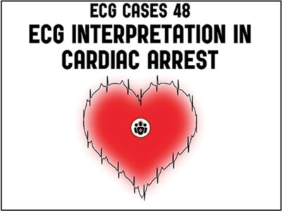 ECG Interpretation in Cardiac Arrest | ECG Cases | Emergency Medicine Cases