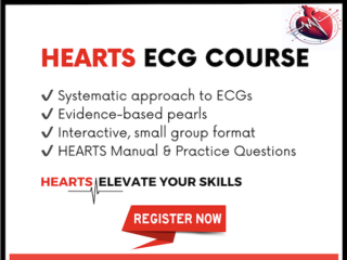 ECG interpretation in chest pain | ECG Cases | EM Cases